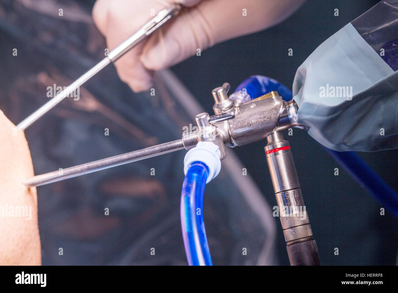 Surgical operation for knee arthroscopy micro surgery in hospital ...