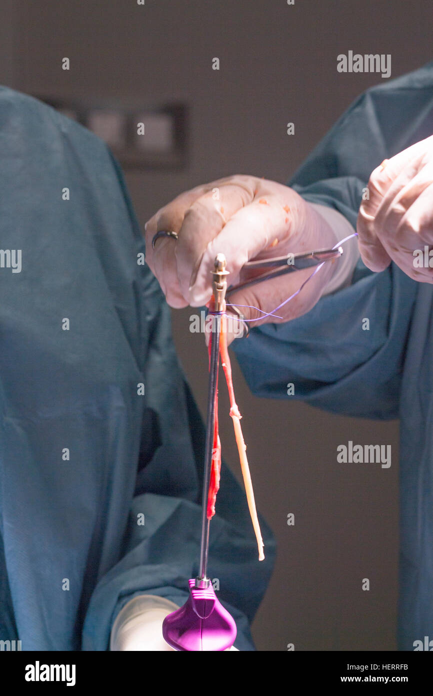 Knee tendon and ligament repair surgery in hospital operating theater ...