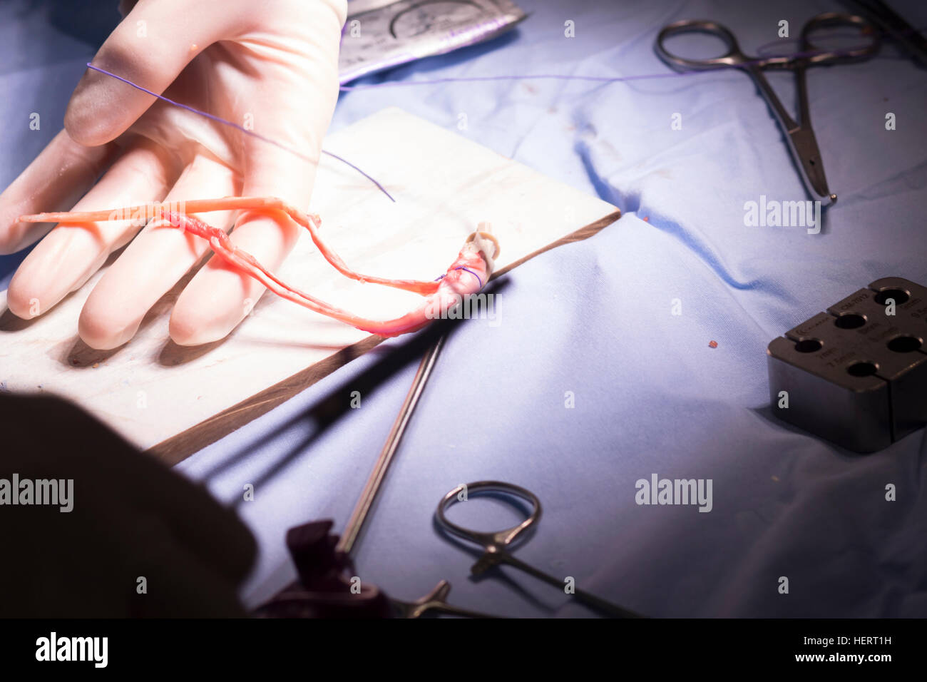 Knee tendon and ligament repair surgery in hospital operating theater ...