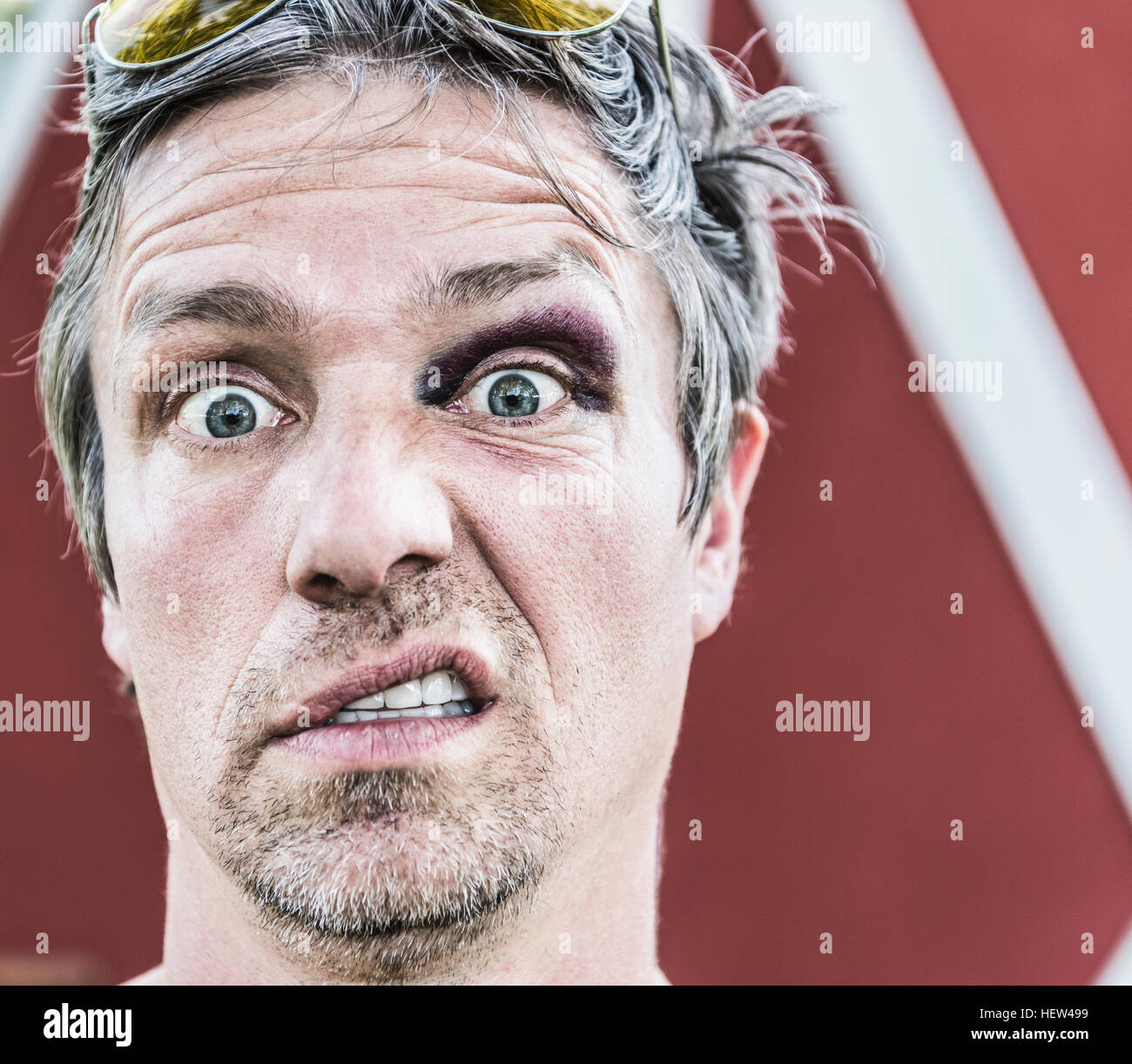 Face of adversity hi-res stock photography and images - Alamy