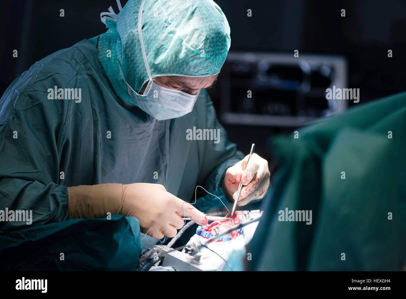 Neurosurgeon closing operation wound Stock Photo - Alamy