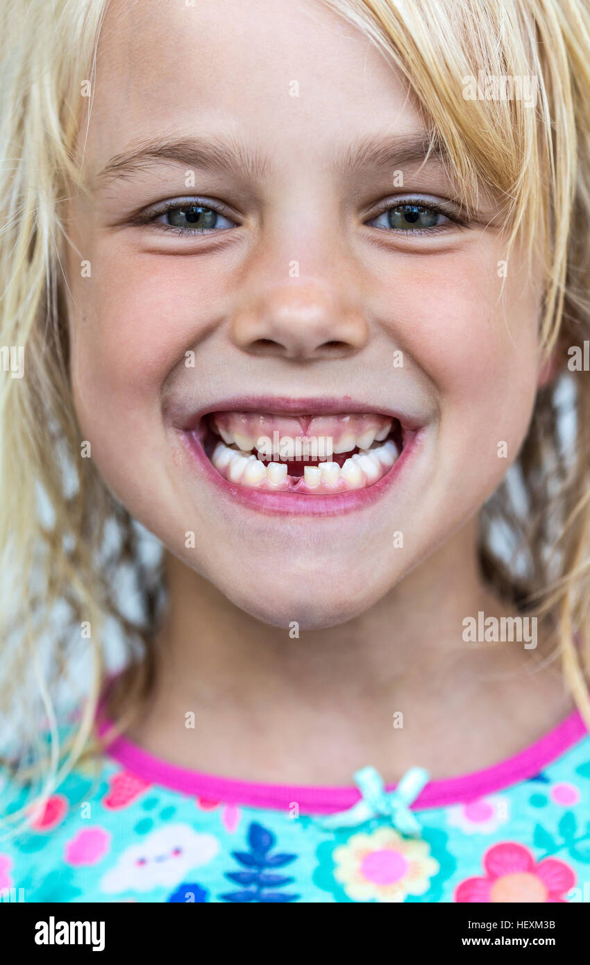 Portrait of little girl showing tooth gap Stock Photo - Alamy