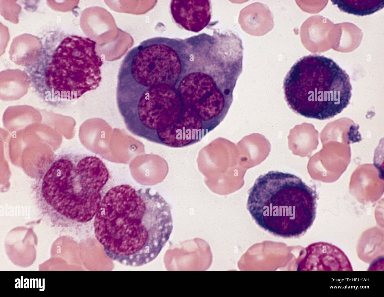 Erythroblast hi-res stock photography and images - Alamy