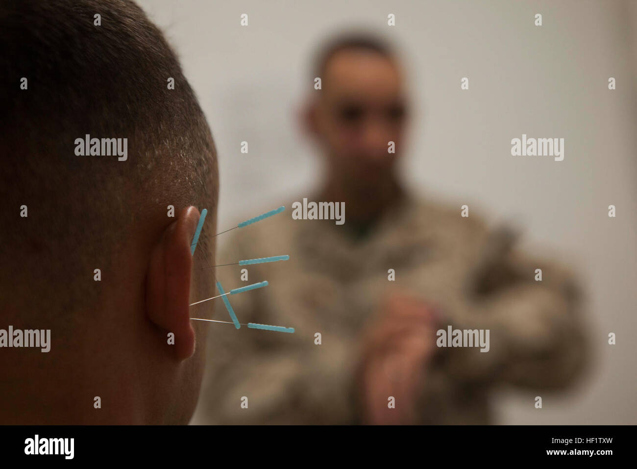 Battlefield Acupuncture High Resolution Stock Photography and Images ...