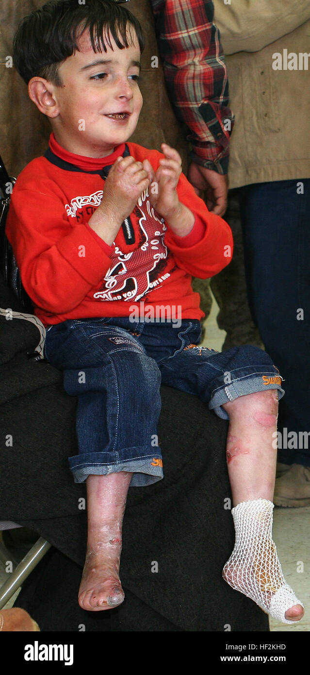 Blisters army hi-res stock photography and images - Alamy