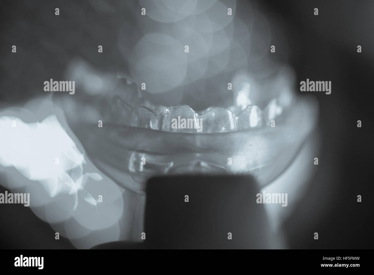 Vibrating dental device with invisible orthodontics Stock Photo - Alamy