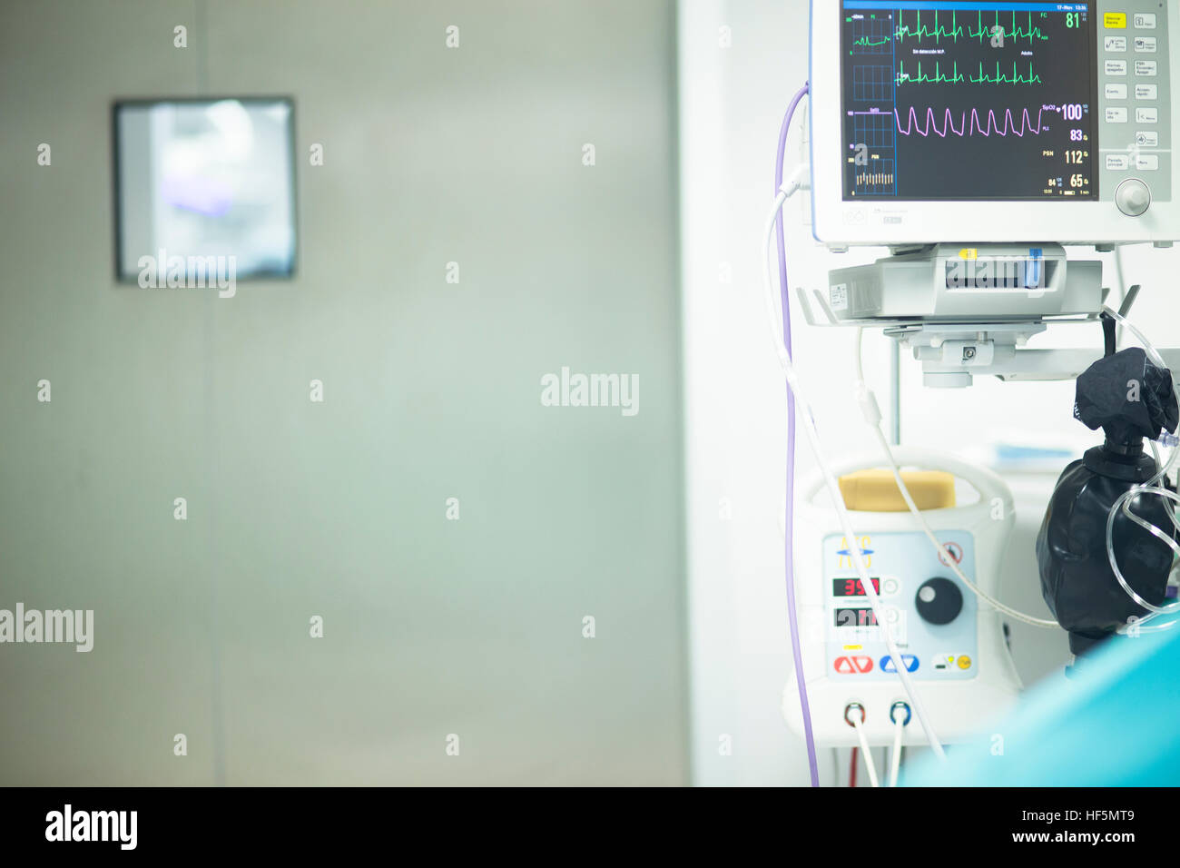 Electrocardiogram in hospital surgery operating theater emergency room ...
