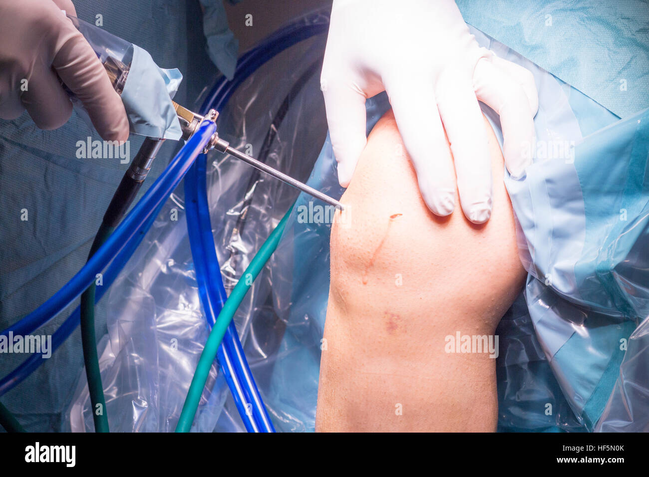 Surgical operation for knee arthroscopy micro surgery in hospital ...