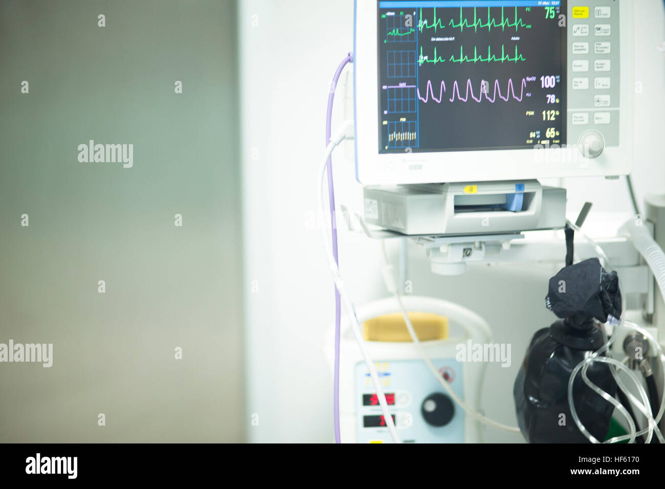Electrocardiogram in hospital surgery operating theater emergency room ...