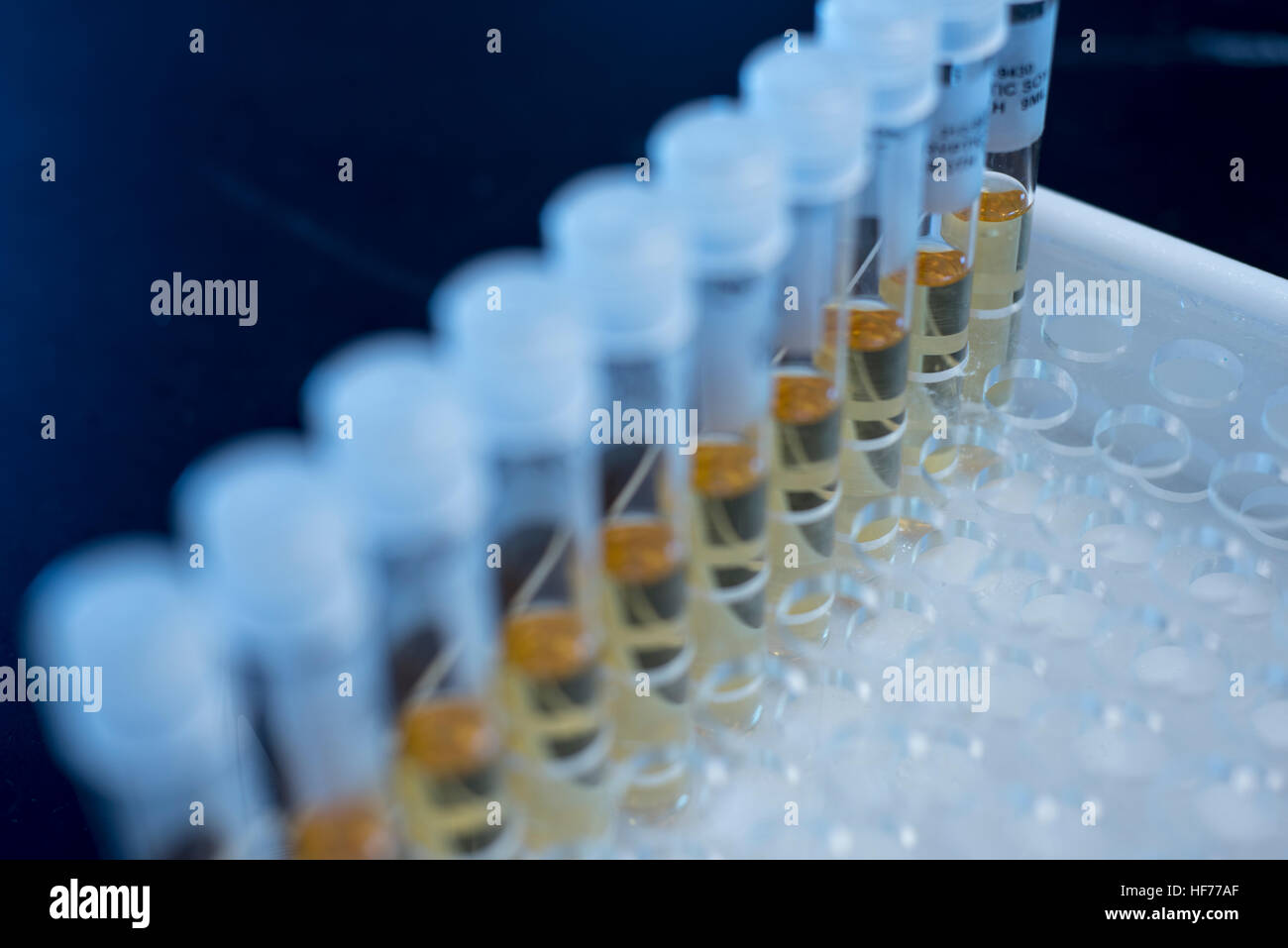scientific research samples of urine in laboratory Stock Photo - Alamy