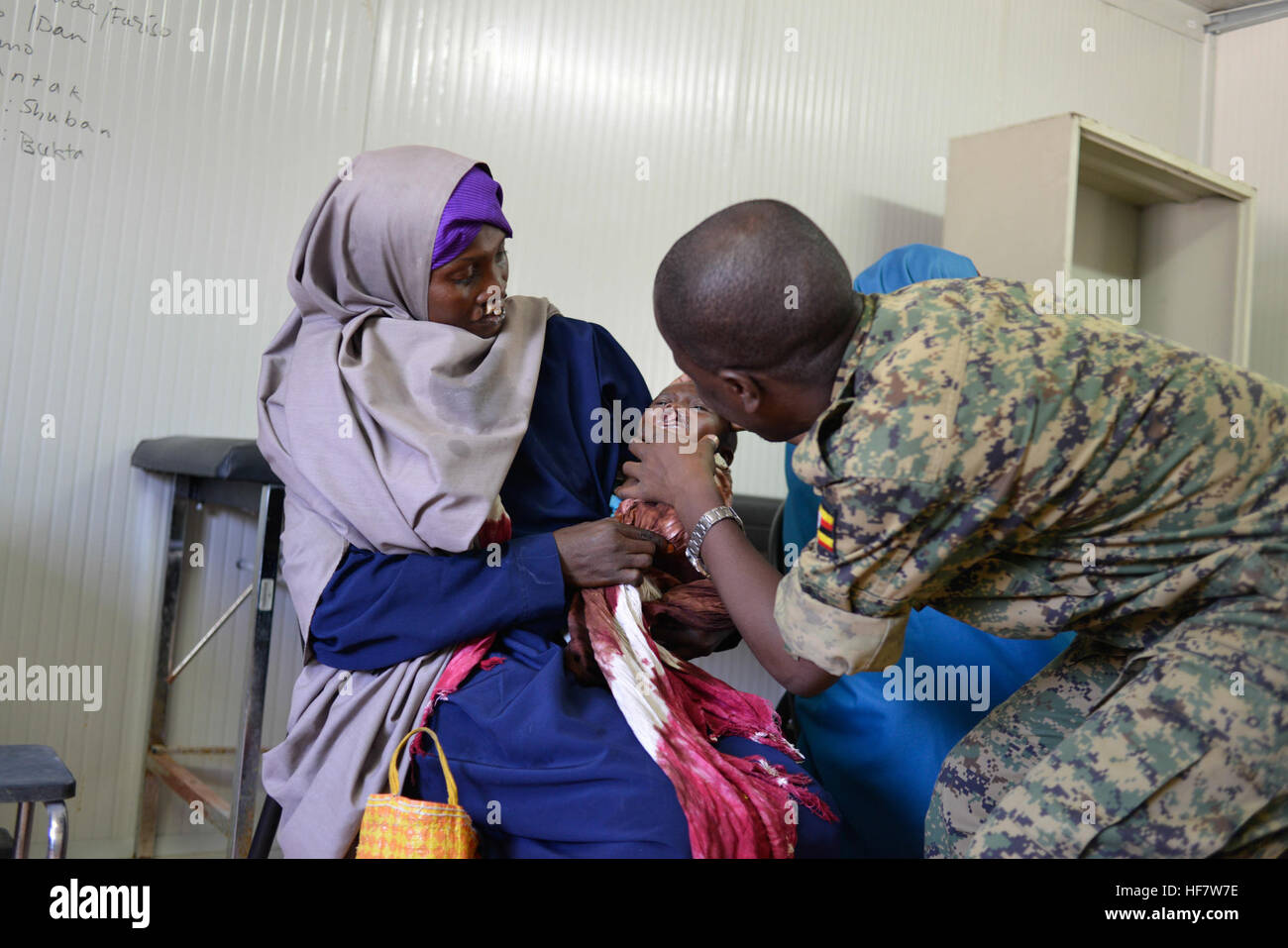 An AMISOM paramedic examines a baby prior to cleft lip surgery in ...