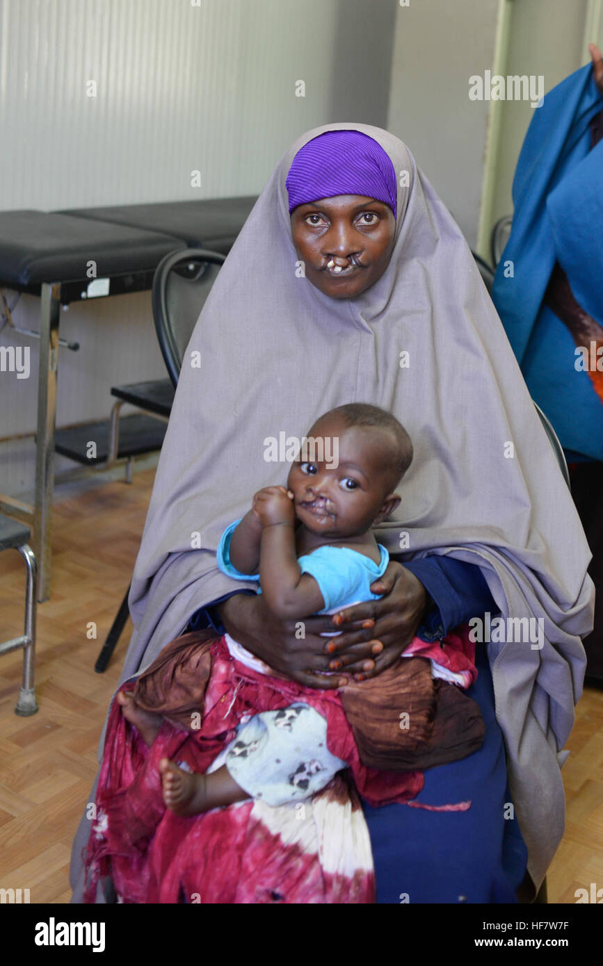 On October 31, 2016, a mother cares for her baby after undergoing ...