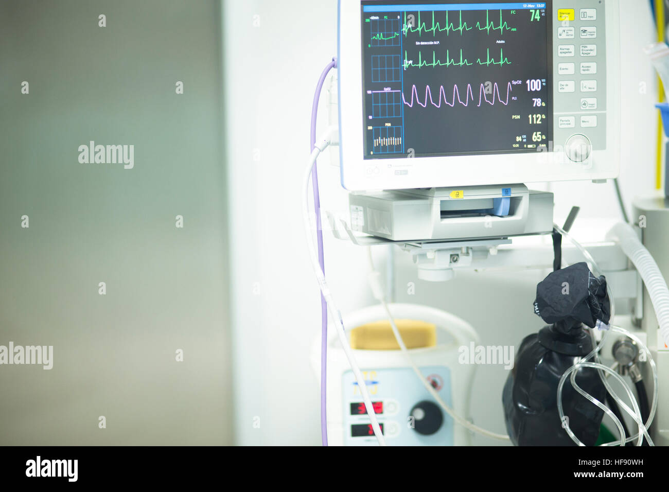Ecg monitor in operating theater hi-res stock photography and images ...