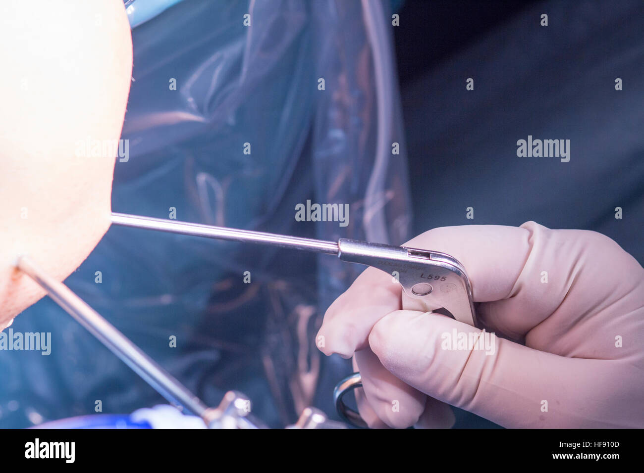 Surgical operation for knee arthroscopy micro surgery in hospital ...