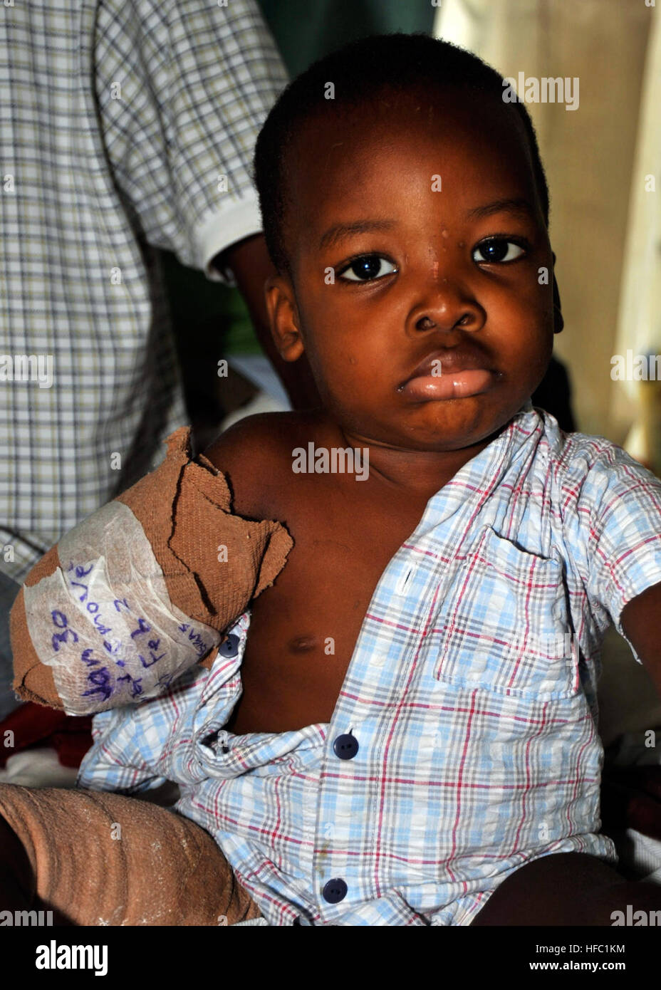 A young boy injured in the Haiti earthquake receives care at Milot ...