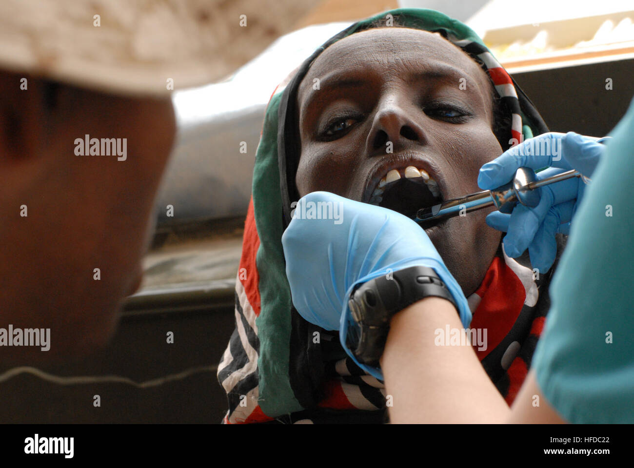 Extracting teeth hi-res stock photography and images - Alamy