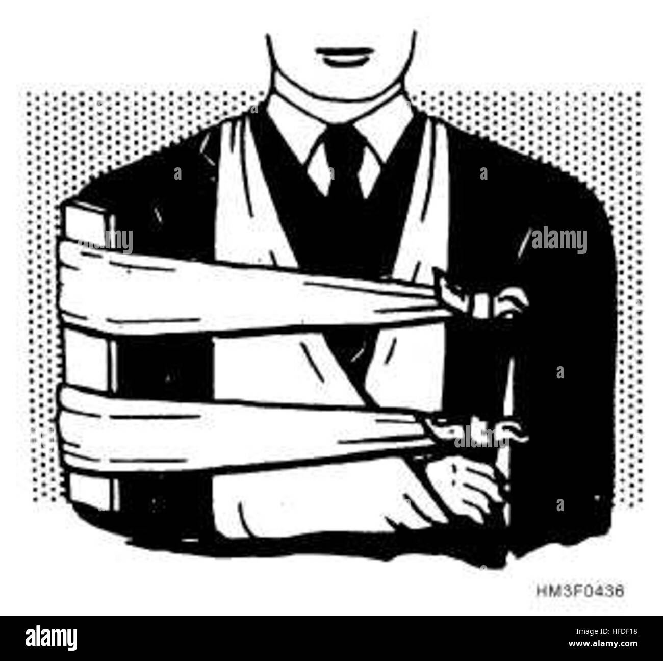 Upper arm splint Stock Photo - Alamy