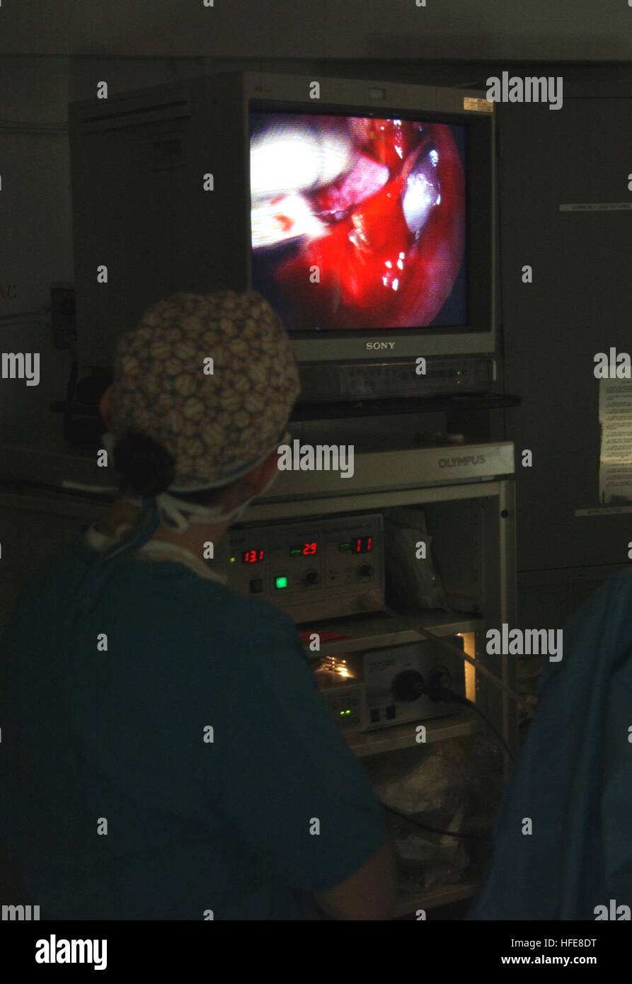 Laparoscopic appendectomy hi-res stock photography and images - Alamy