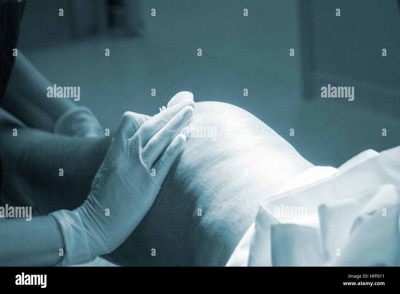 Nurse sterilising for surgical operation knee arthroscopy micro surgery ...