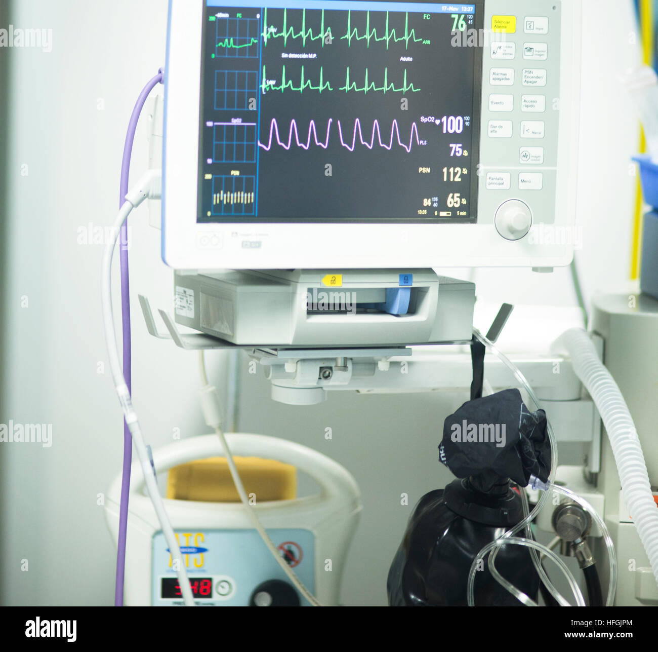 Electrocardiogram in hospital surgery operating theater emergency room ...