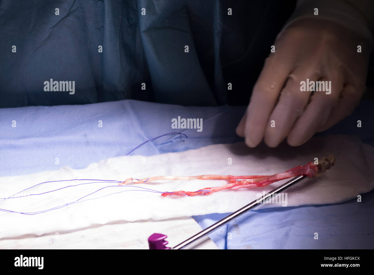 Knee tendon and ligament repair surgery in hospital operating theater ...