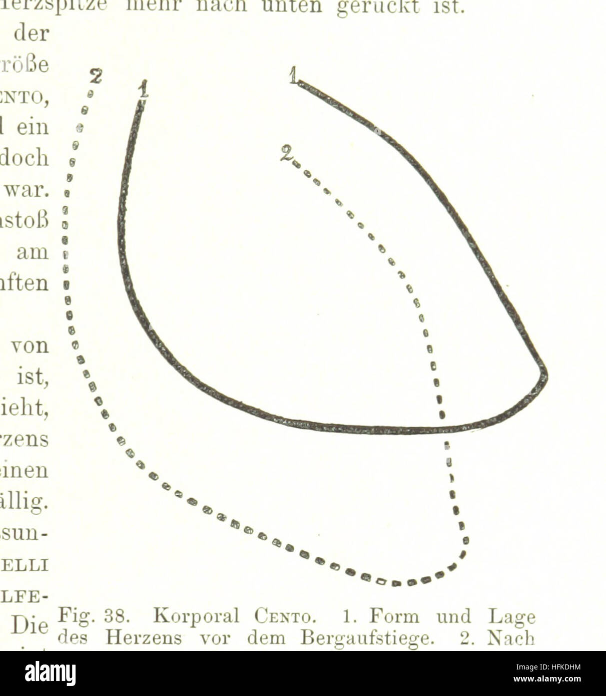 Page 123 of 'Der Mensch auf den Hochalpen' by Angelo Mosso, showcasing ...