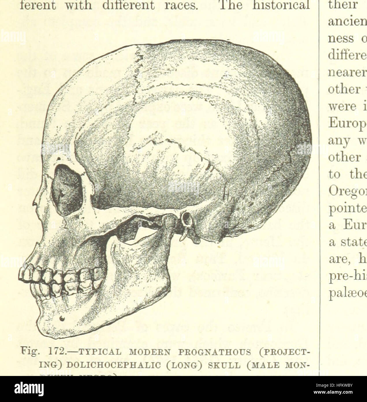 Dolichocephalic hi-res stock photography and images - Alamy
