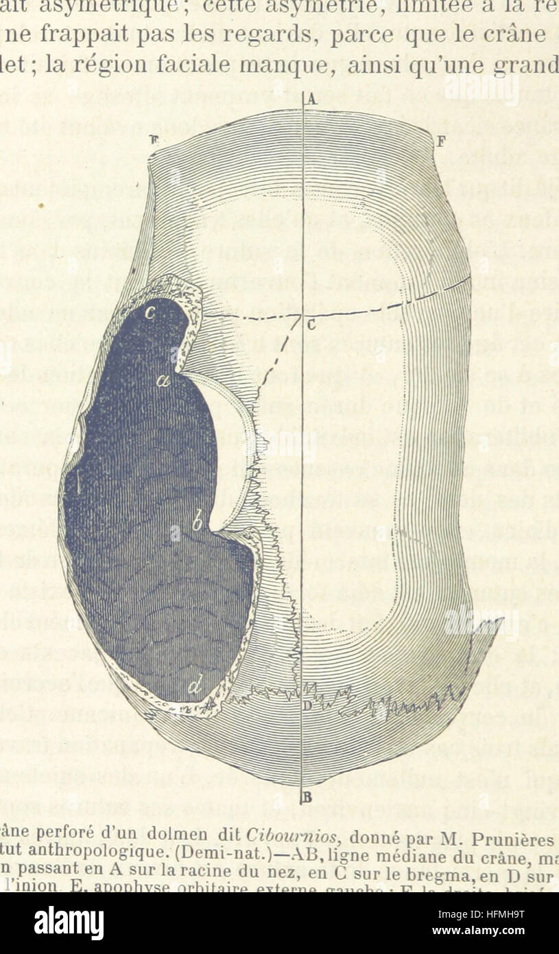 Study of cranial trepanation and the use of cranial amulets during the ...
