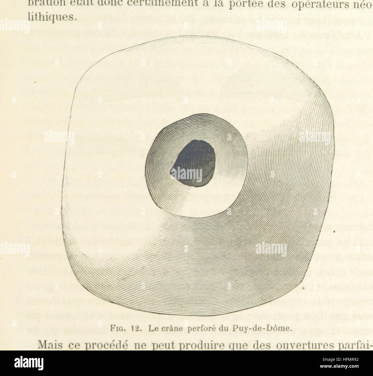 Ancient trepanation tools hi-res stock photography and images - Alamy