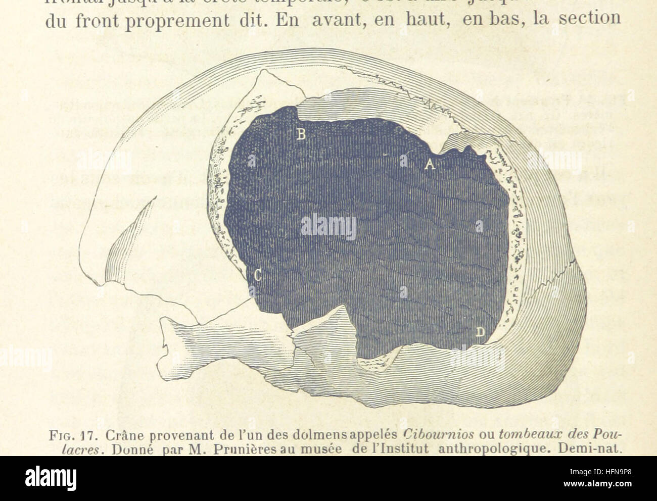 Ancient trepanation tools hi-res stock photography and images - Alamy