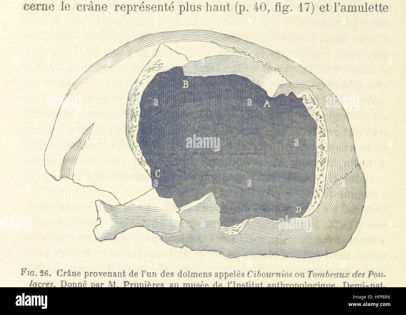 An exploration of skull trepanation and the use of cranial amulets ...