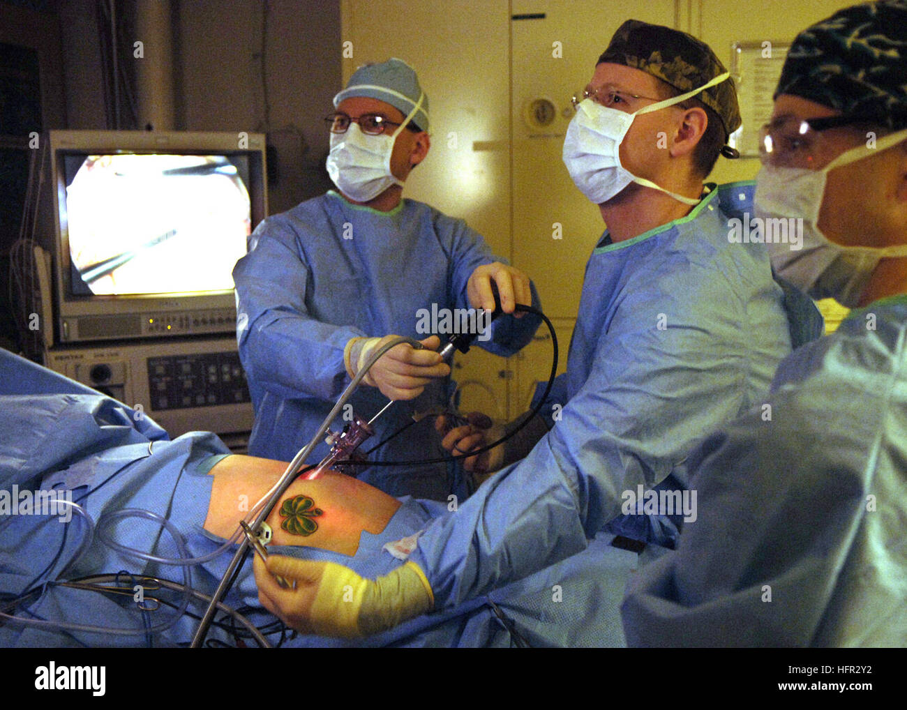 Laparoscopic appendectomy hi-res stock photography and images - Alamy