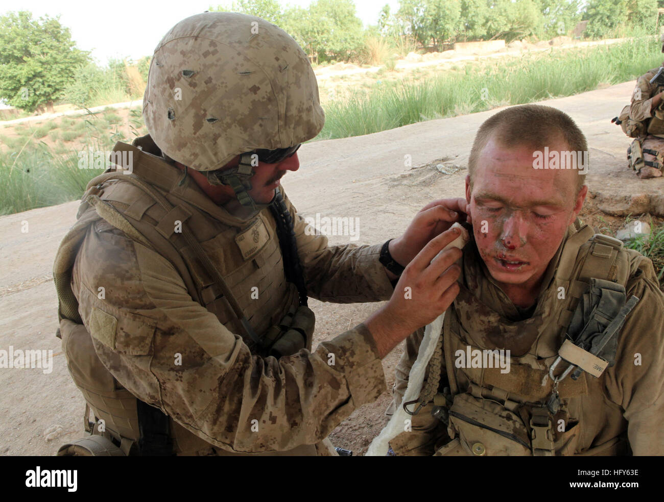 Facial wounds hi-res stock photography and images - Alamy