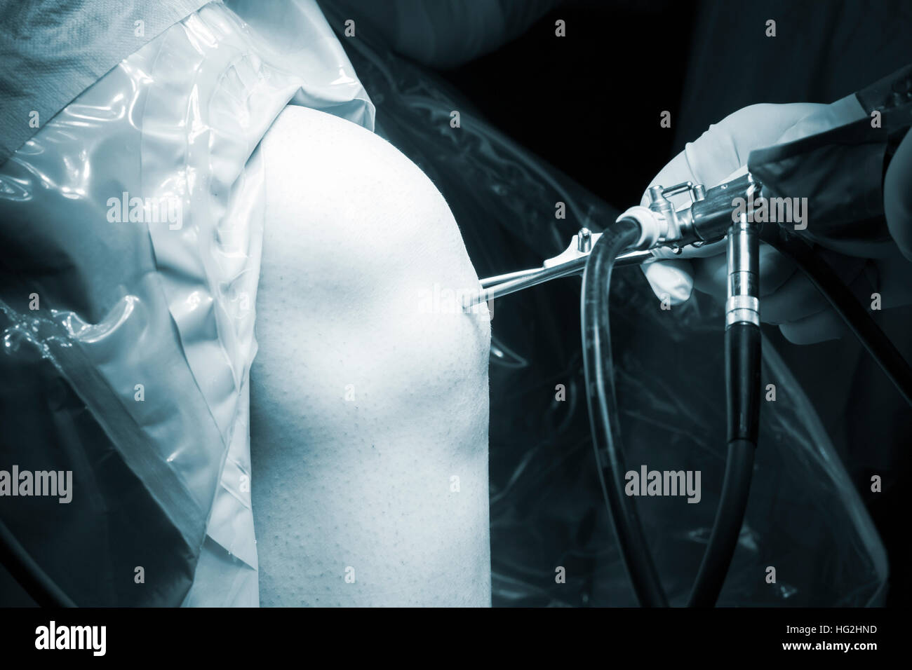 Surgical operation for knee arthroscopy micro surgery in hospital ...