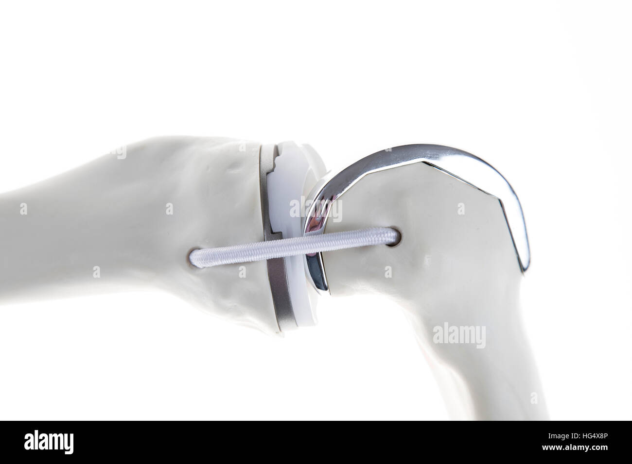 Knee prosthesis, knee endoprosthesis or knee joint prosthesis, on a ...