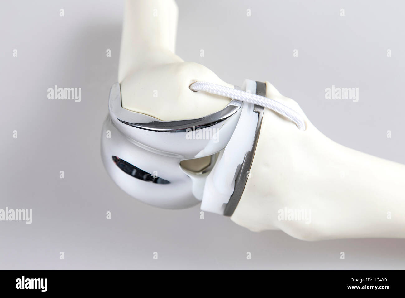 Knee endoprosthesis hi-res stock photography and images - Alamy