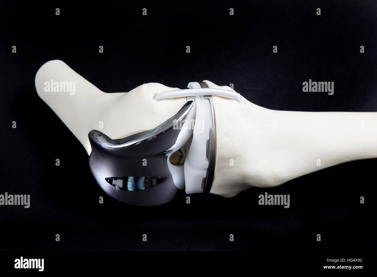 Knee endoprosthesis hi-res stock photography and images - Alamy