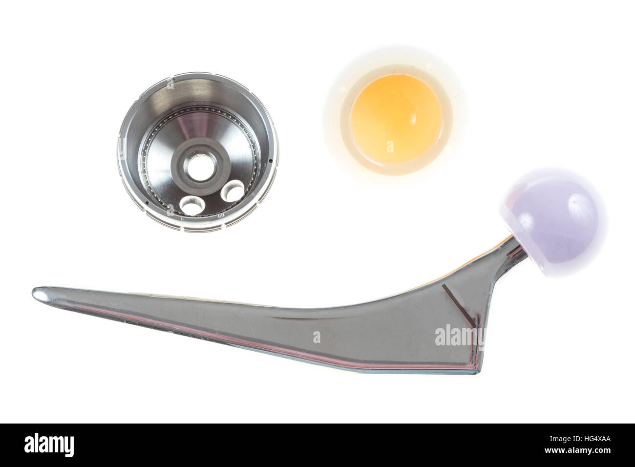 Endoprosthesis, artificial hip joint, consists of the hip stem, ball ...