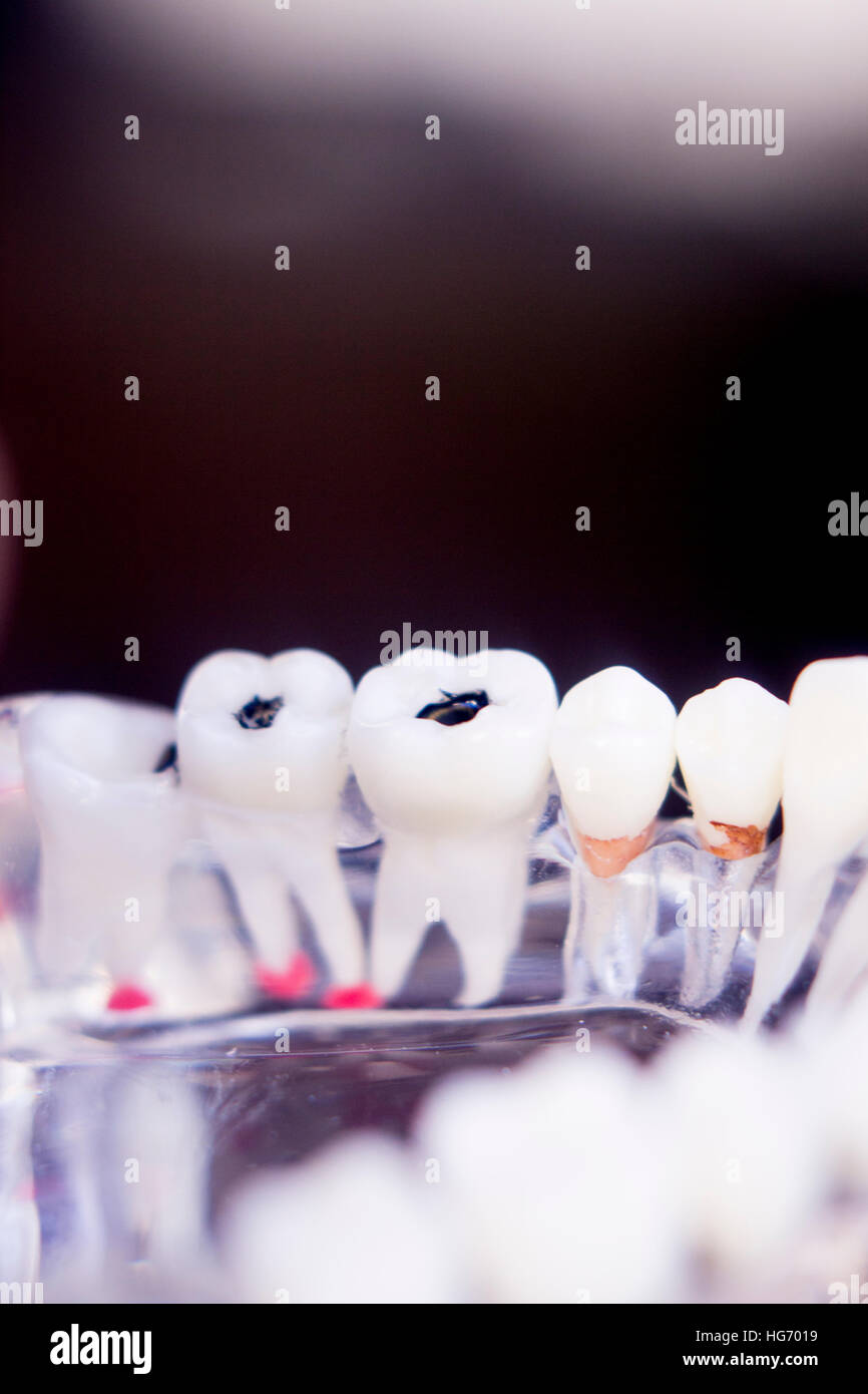 Dentists tooth plastic model used for teaching, learning and patient ...