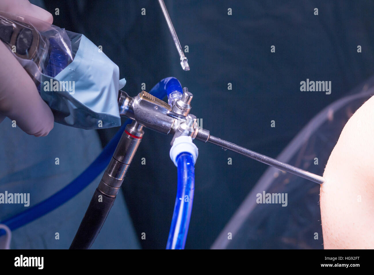 Surgical operation for knee arthroscopy micro surgery in hospital ...