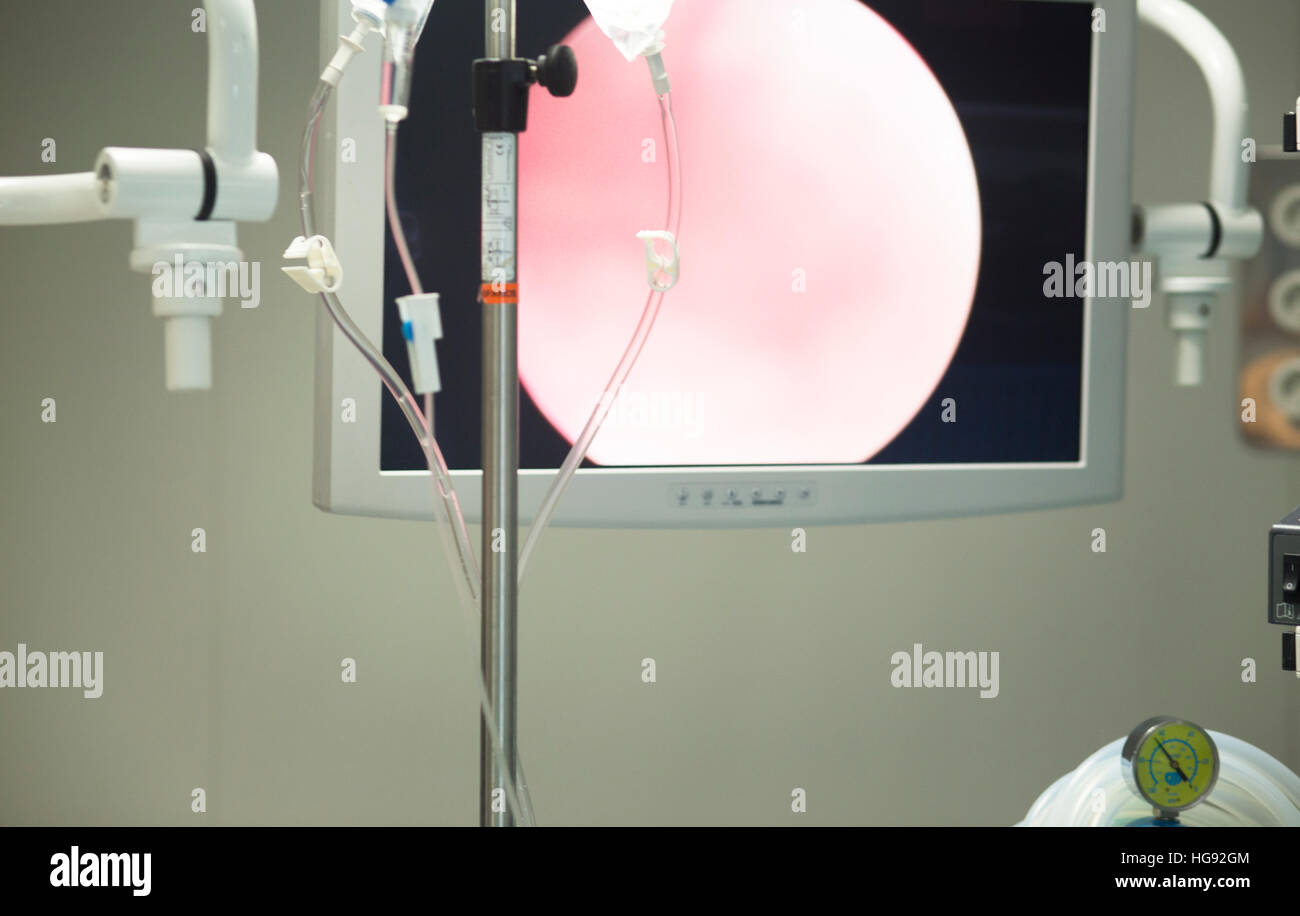 Arthroscopy surgery screen showing arthroscope camera picture in knee ...
