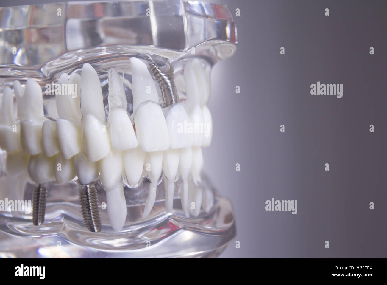 False teeth sample for dentists Stock Photo - Alamy