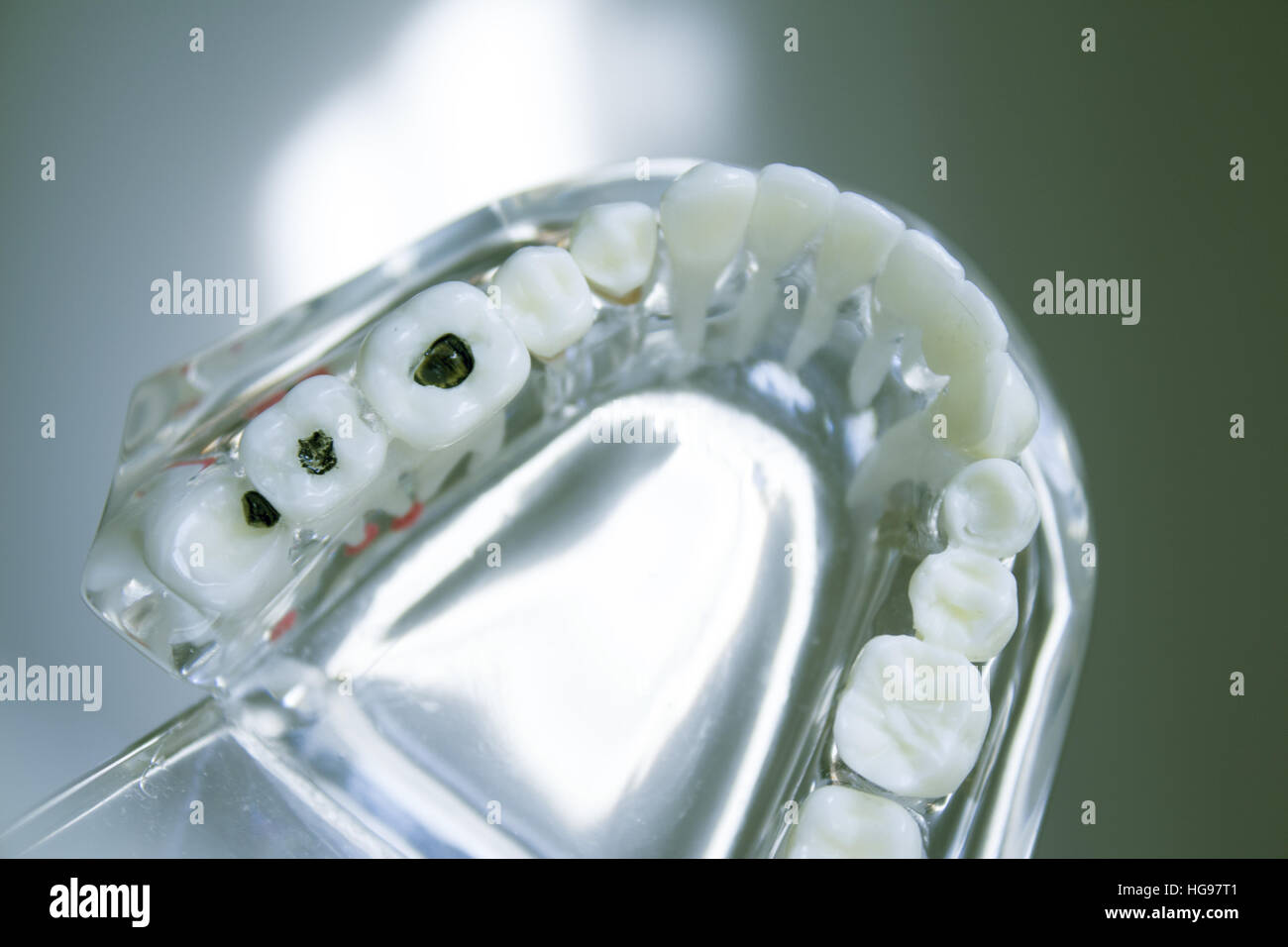 False teeth sample for dentists Stock Photo - Alamy