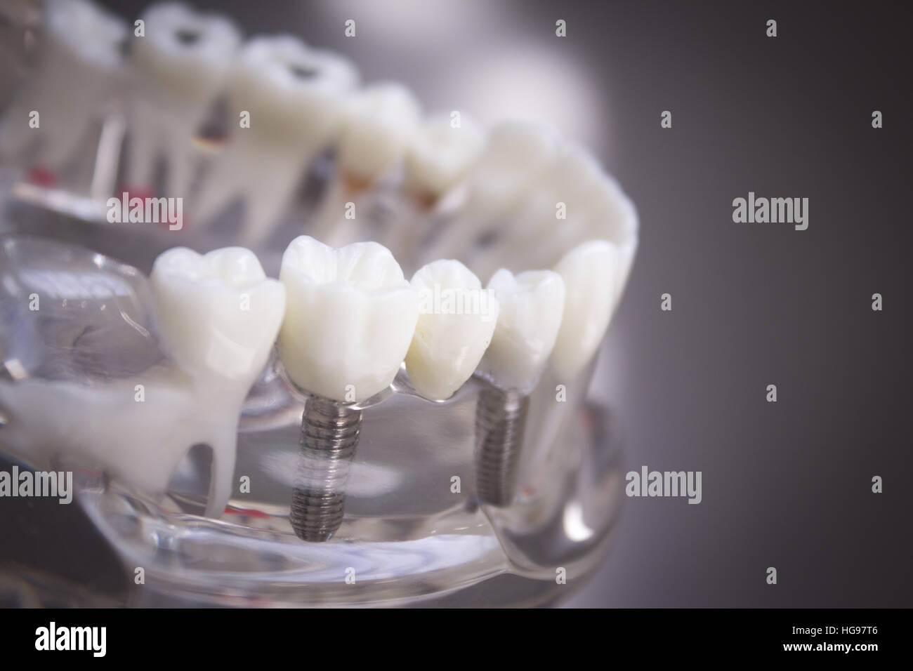 False teeth sample for dentists Stock Photo - Alamy