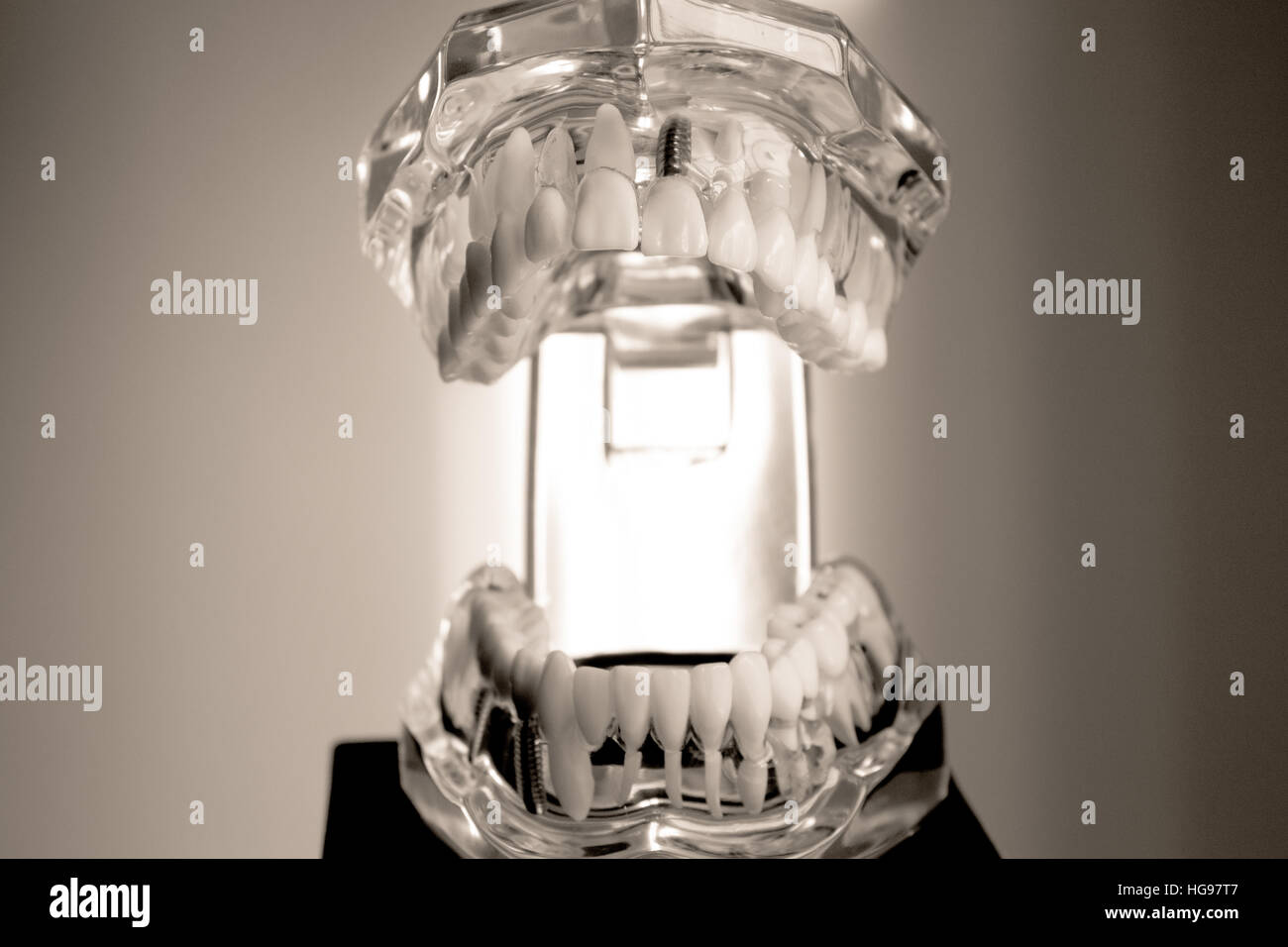 False teeth sample for dentists Stock Photo - Alamy