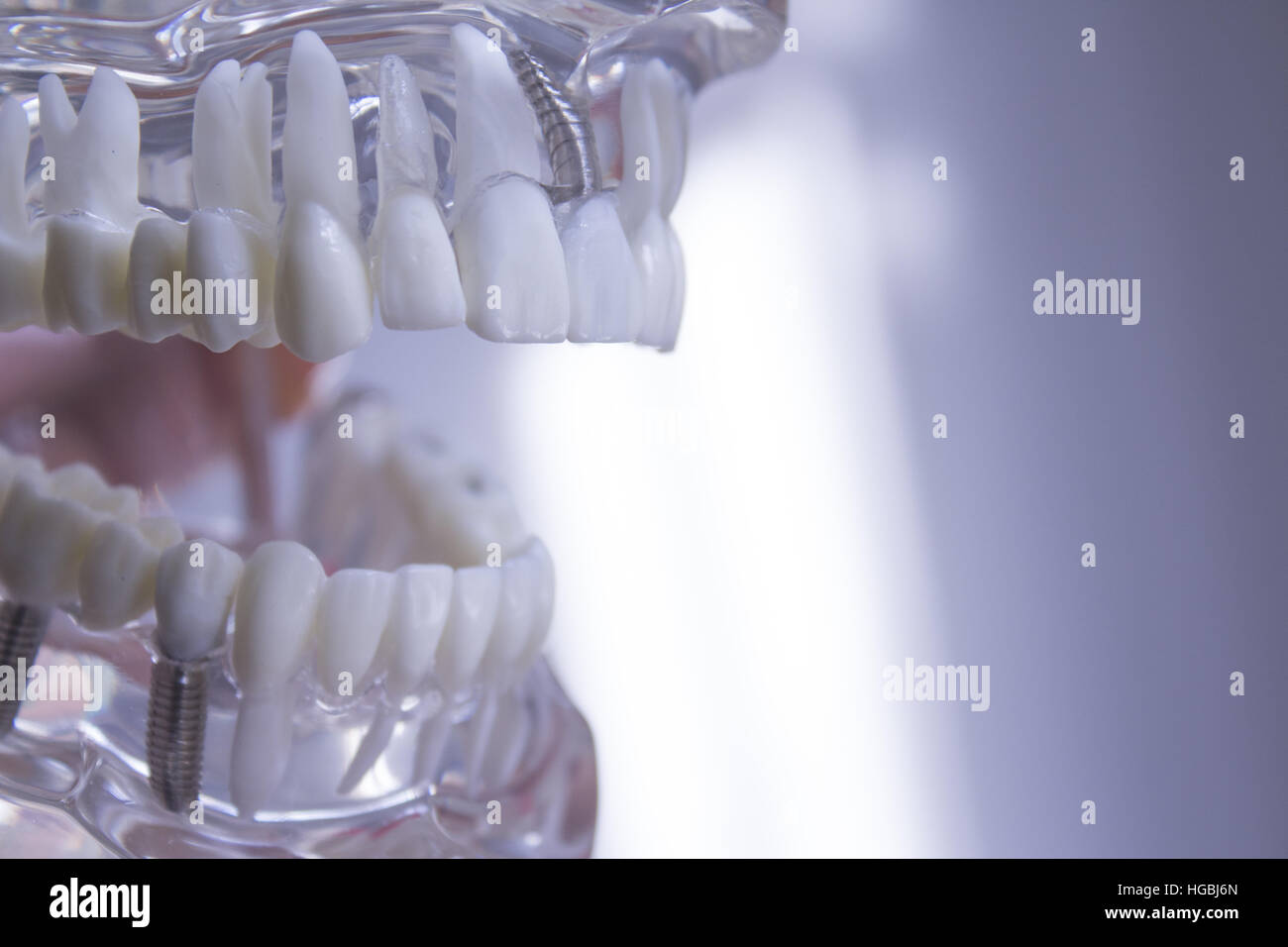 False teeth sample for dentists Stock Photo - Alamy