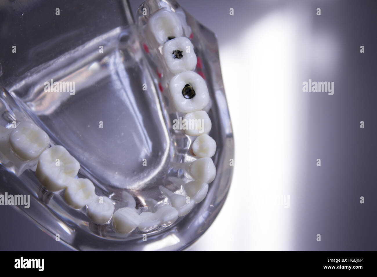 False teeth sample for dentists Stock Photo - Alamy