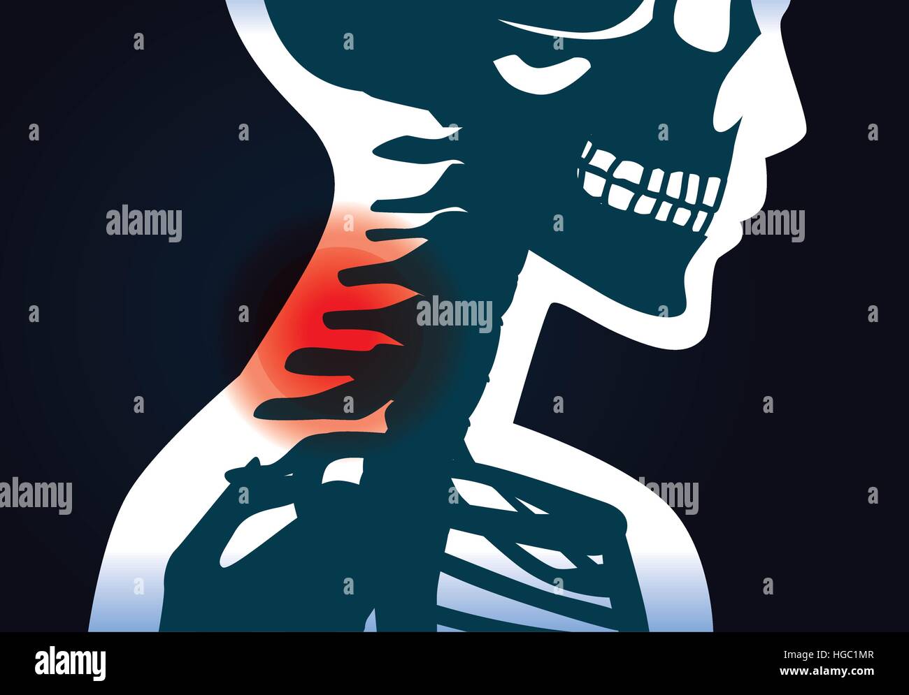Painful symptom Stock Vector Images - Alamy