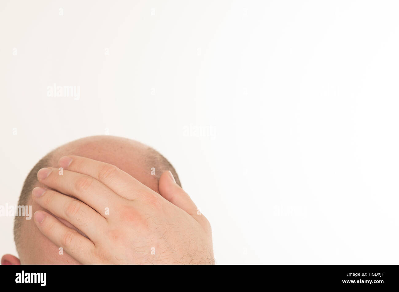 Man with hand on head Stock Photo - Alamy