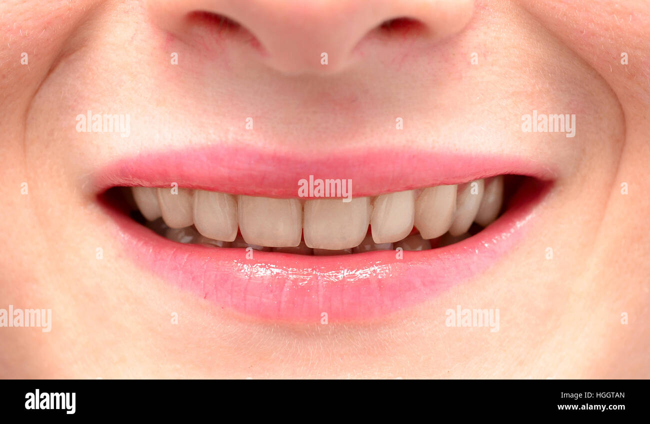 Rotten teeth woman hi-res stock photography and images - Alamy